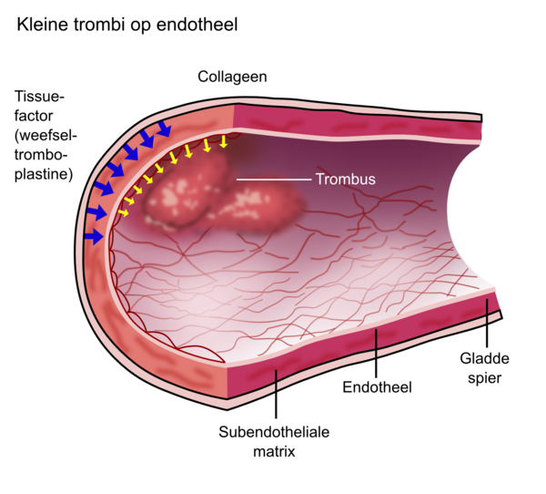 De basisbeginselen van stolling - THROMBOpedia
